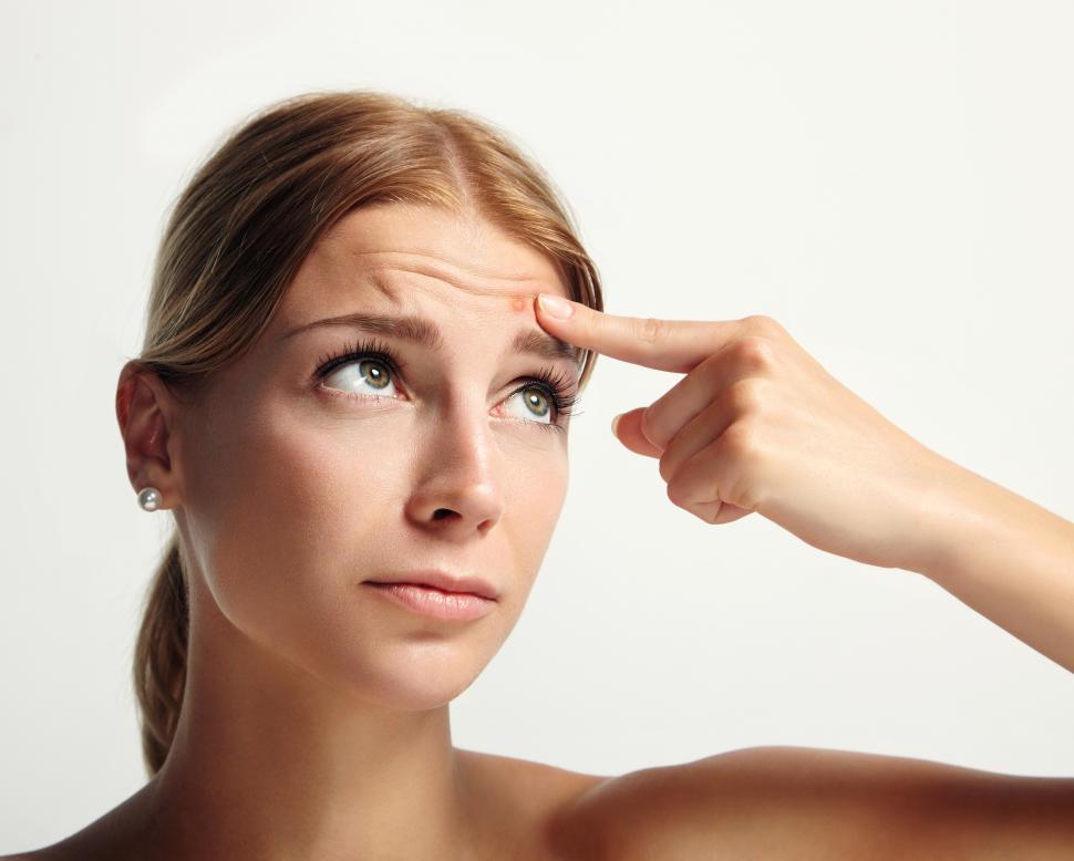 Free Stock Photo of Woman indicates with a finger a pimple on her ...