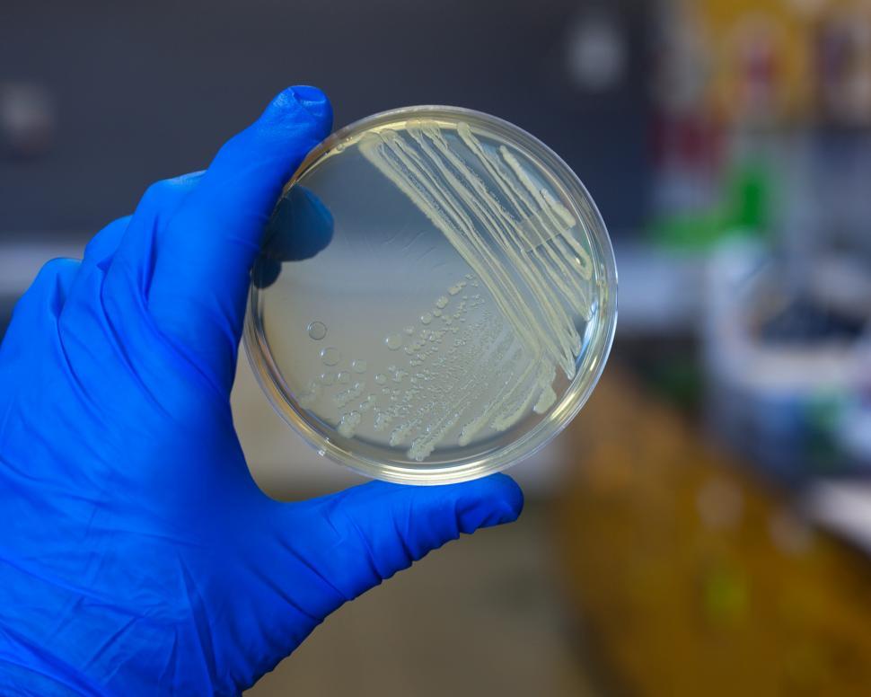 Free Stock Photo of Bacteria | Download Free Images and Free Illustrations