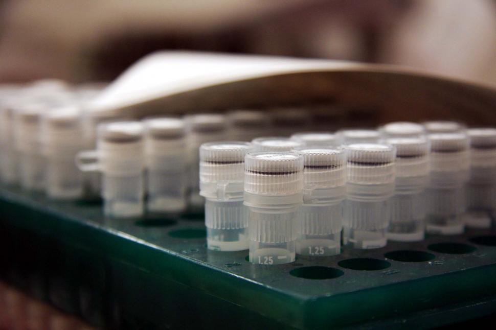 Free Stock Photo of DNA samples | Download Free Images and Free ...